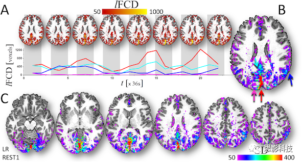 思影科技功能磁共振(fMRI)数据处理业务 - 知乎