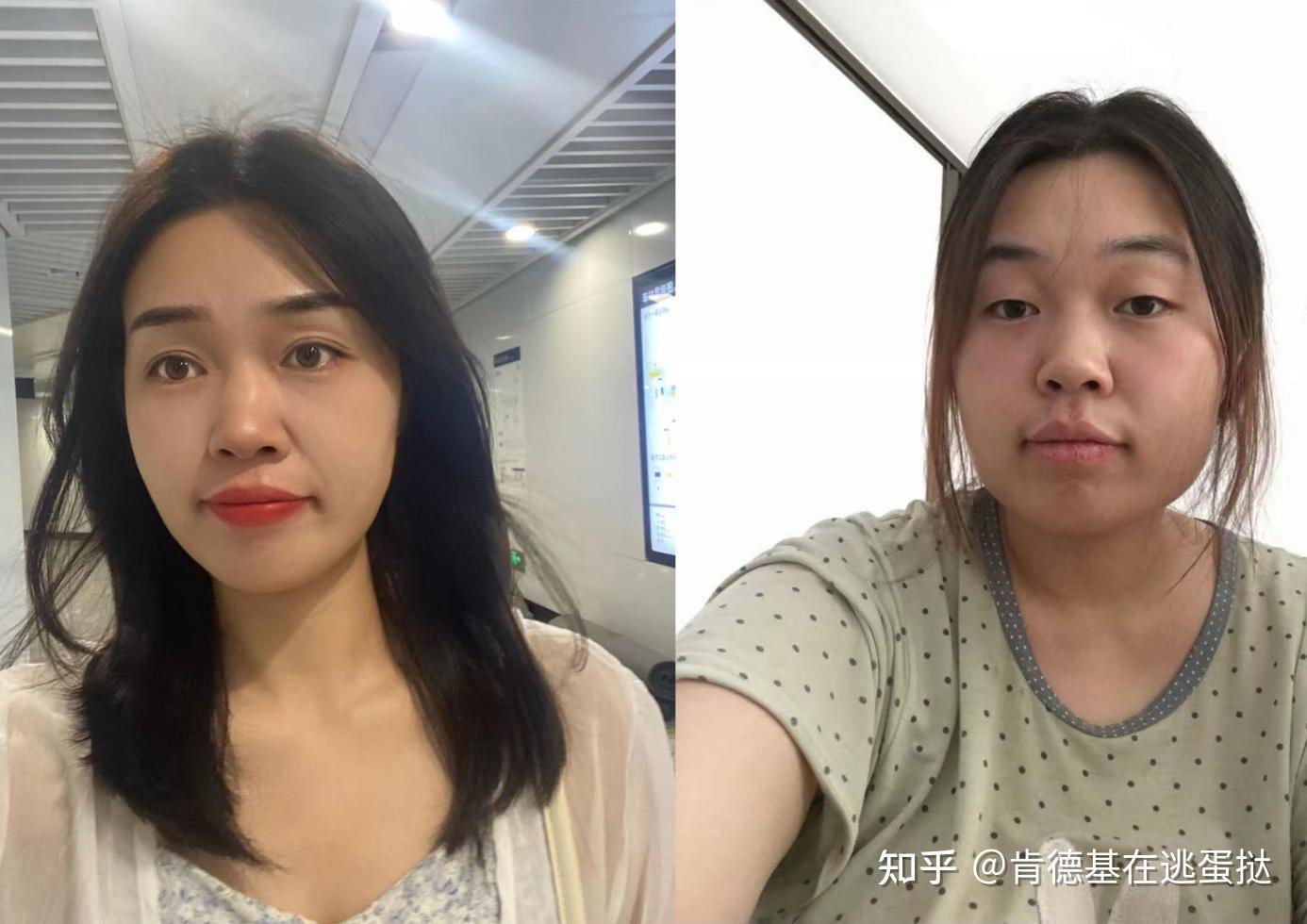 有没有哪种减肥不节食还能瘦的方法？ 知乎