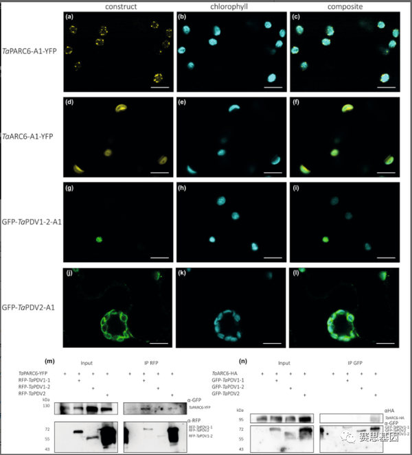 【New Phytol】PARC6的突变增加了小麦胚乳淀粉体大小从而影响淀粉颗粒形态 - 知乎