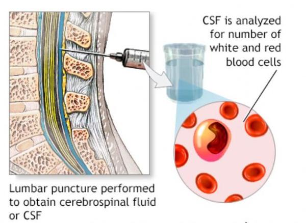Cytomark脑脊液储存管-活性持续72h！ - 知乎
