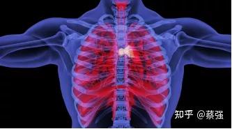 重建免疫力！FDA批准头一款产品治疗先天无胸腺症 - 知乎