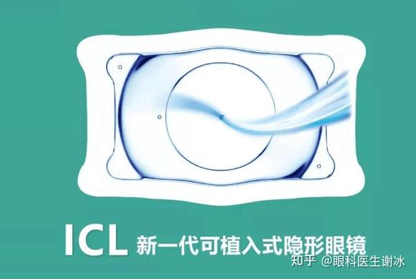 选择EVO ICL的五大优势 - 知乎