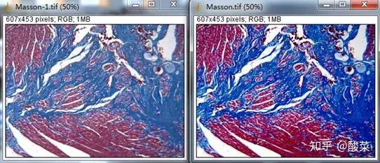 如何用ImageJ进行面积分析？ - 知乎