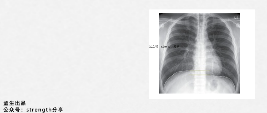 PRI姿势恢复是什么？ - 知乎