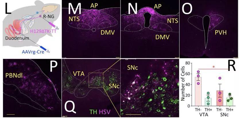 【文献解读】Cell丨脑肠轴如何调控奖赏系统？ - 知乎