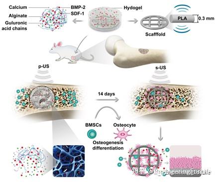 《Bioact. Mater.》：声学响应支架募集内源性干细胞用于骨缺损原位修复 - 知乎