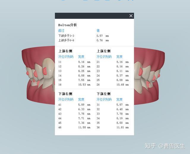 什么是Bolton比例不调？ - 知乎