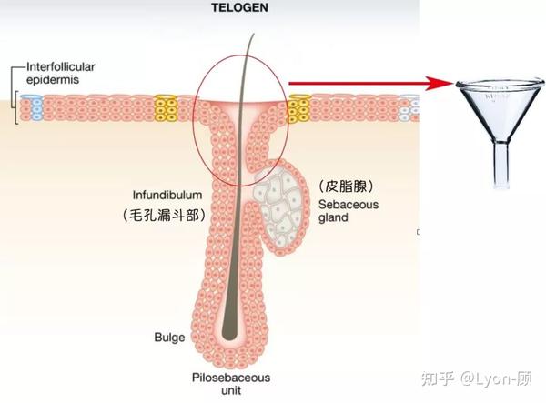黑头总是去不掉？那可能根本不是黑头啊 知乎