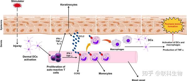 趋化因子CCL2/MCP-1 - 知乎