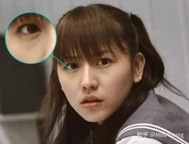 大美女们为什么不割眼袋?这篇文章告诉你! 知乎