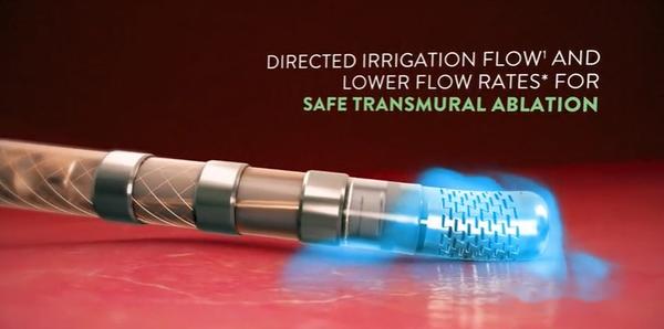 雅培独家！消融导管获批CE上市 - 知乎