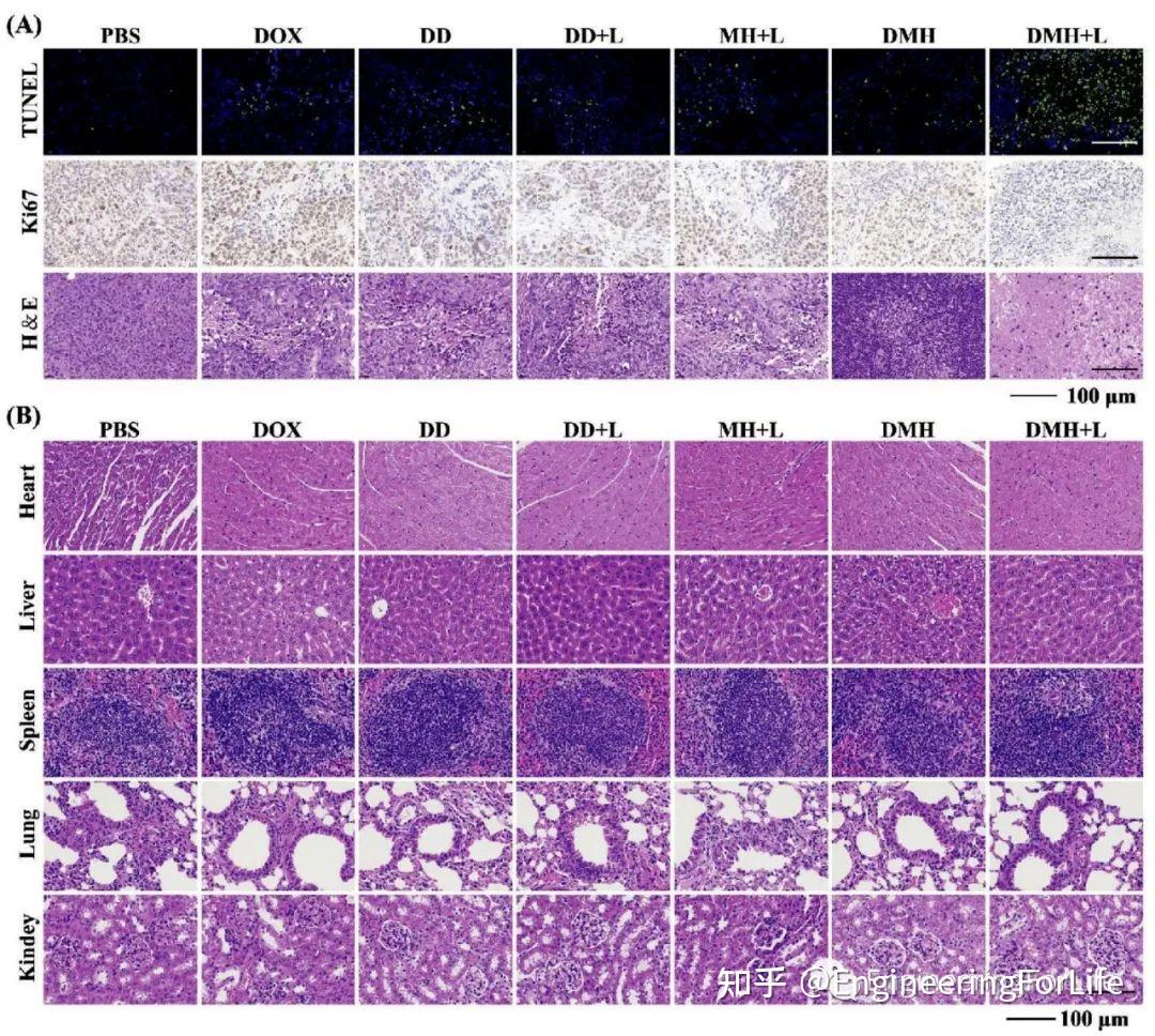 《Small》:用于NIR触发局部光热-化疗协同癌症治疗的热响应 MXene-DNA 水凝胶 - 知乎