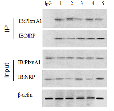 免疫共沉淀(Co-IP)详细操作流程 - 知乎