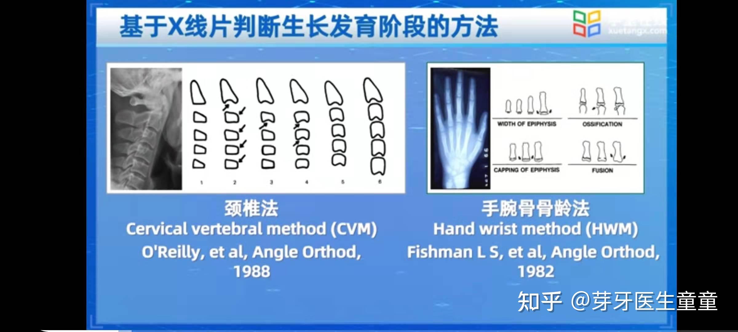 正畸课程自学笔记 - 知乎