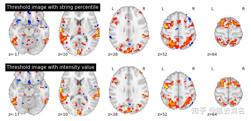 nilearn 笔记（16） - 知乎