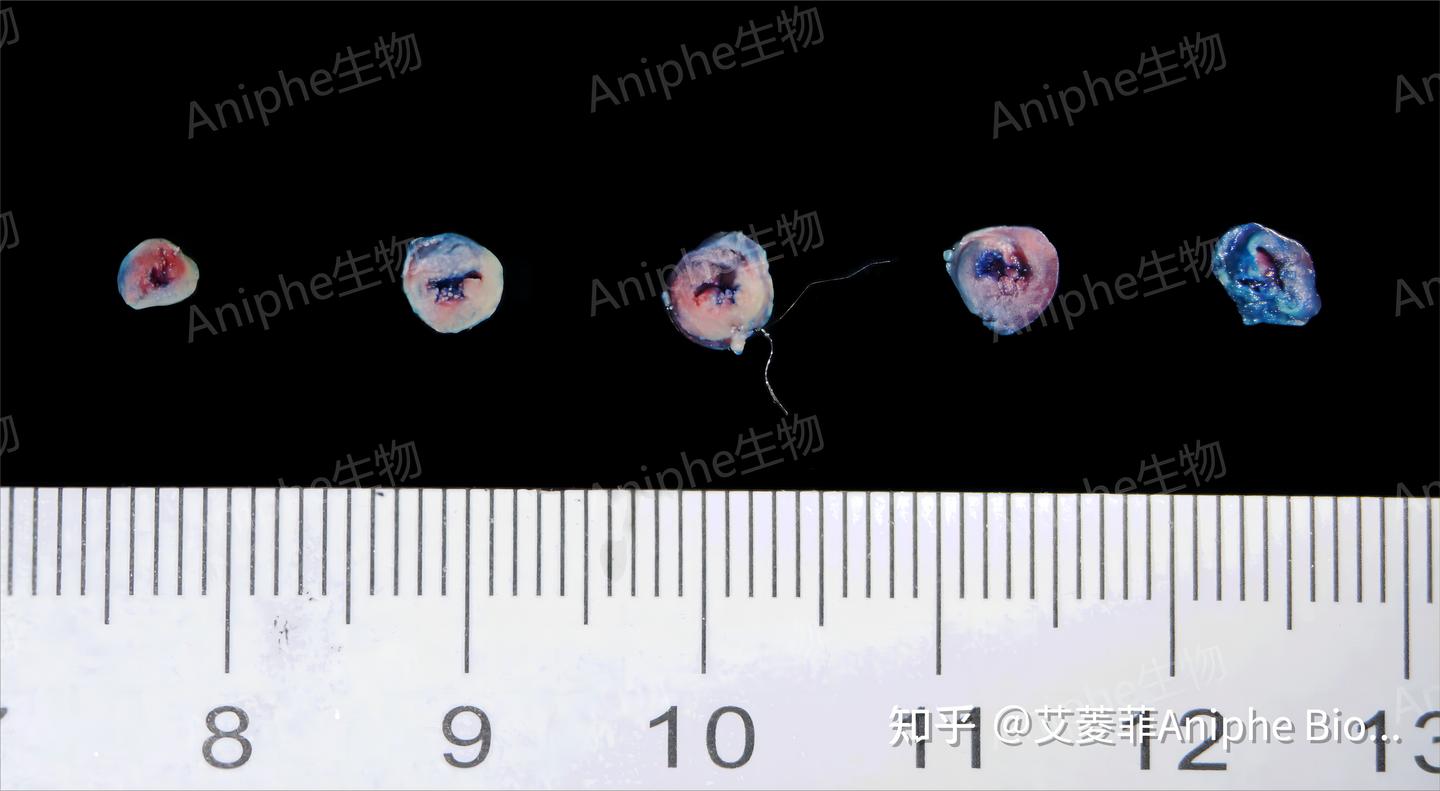 疾病模型|胸腔挤压法冠状动脉左前降支(LAD)结扎建立小鼠心肌缺血模型 - 知乎