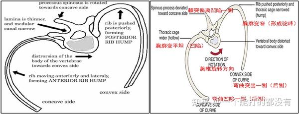 PRI(姿势恢复技术)官方视频及教材学习笔记 - 知乎