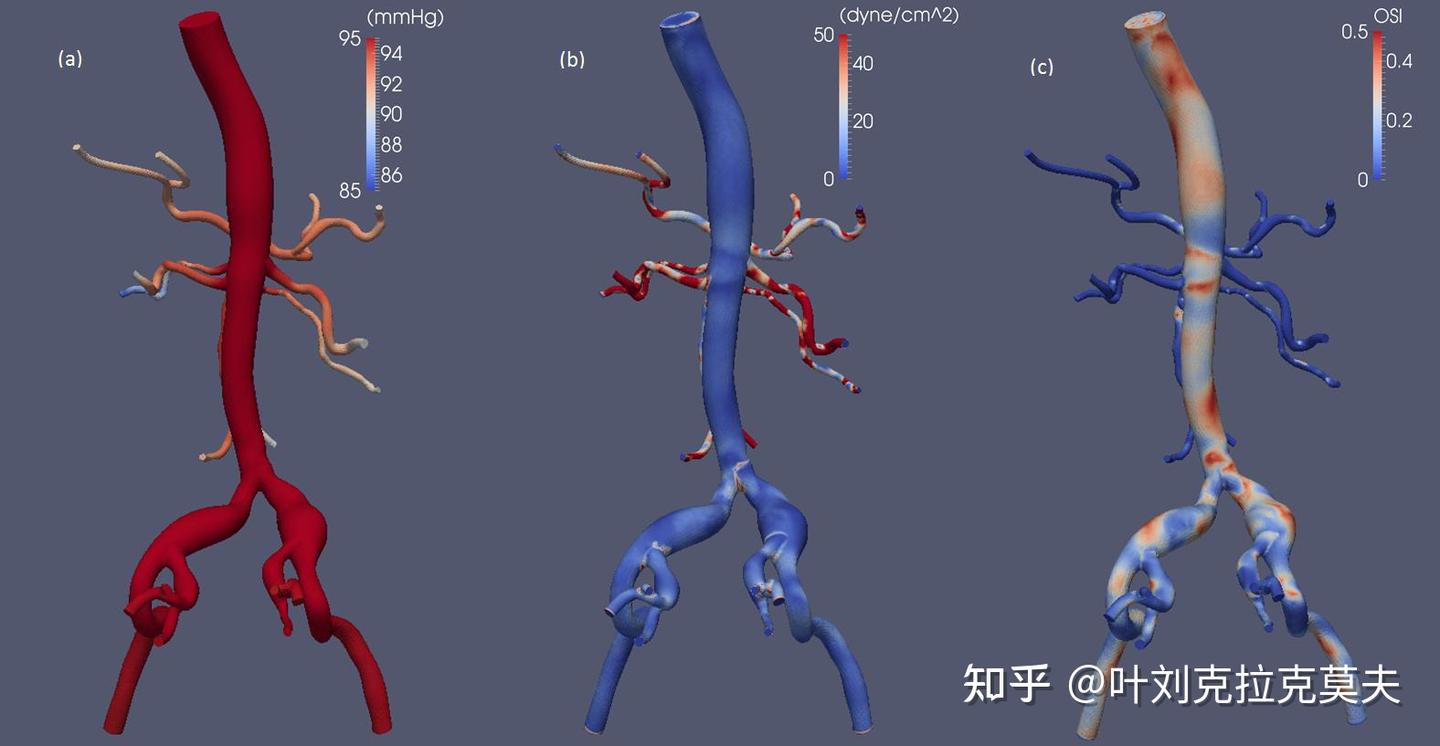 开源科学工程技术软件介绍 – 血流模拟和分析软件Simvascular - 知乎