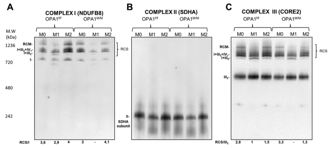 CDD丨OPA1 通过 p65 信号驱动巨噬细胞代谢和功能承诺 - 知乎
