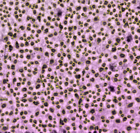 Imagej图像处理实践（ImageJ学习-图像处理 545367350） - 知乎