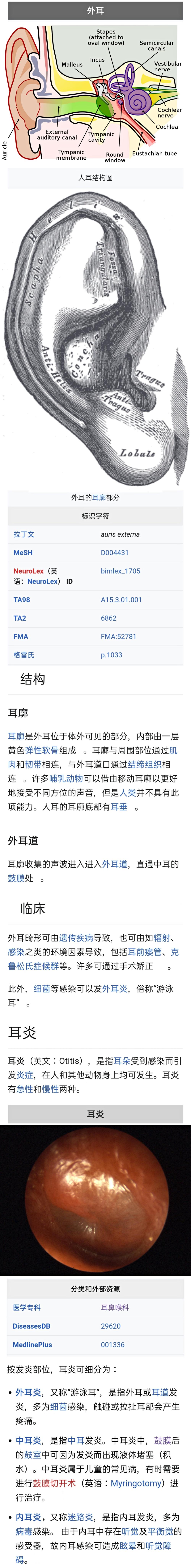 鼓膜穿孔与传导性听力损失/中耳炎/鼓室成形术 - 知乎