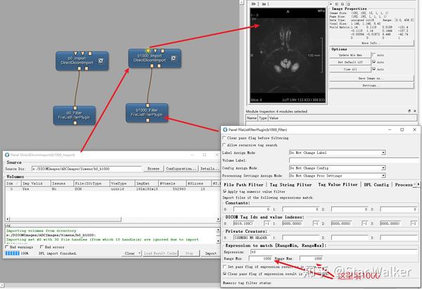 用MeVisLab来计算ADC值，并做对比（上） - 知乎