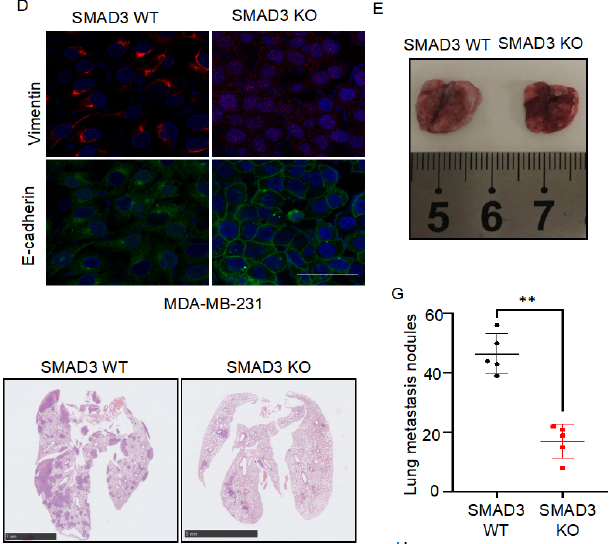 JCI：武汉同济医院研究团队发现了SMAD3甲基化促进肿瘤侵袭转移的新机制 - 知乎