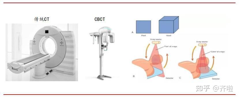 【齐啦】齐声众口第13期-口腔CBCT：崛起中的国产力量 - 知乎