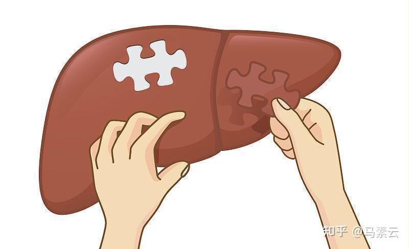 辟谣！体检出现脾大，就是肝硬化了？医生告诉您实情 知乎