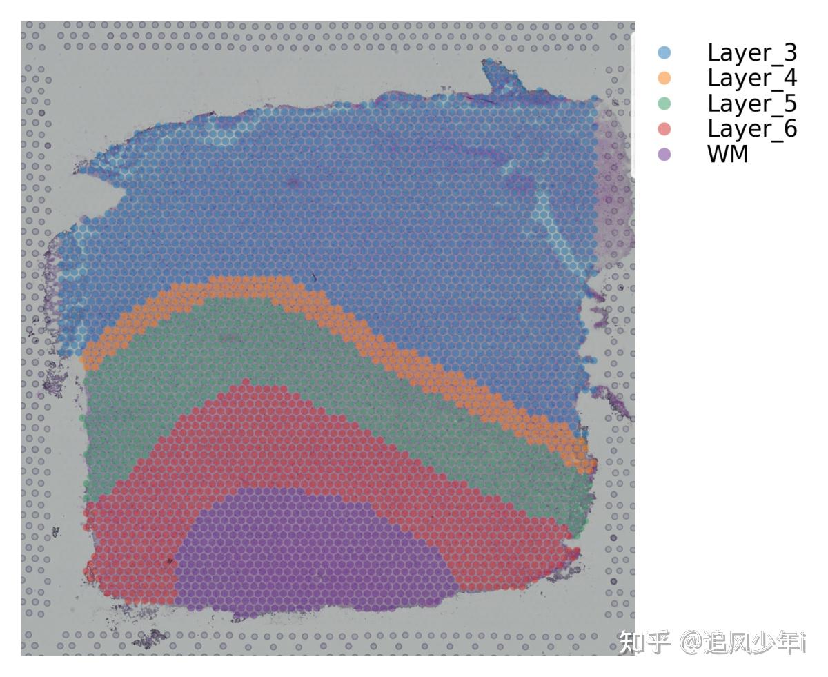 10X单细胞空间回顾之stlearn - 知乎