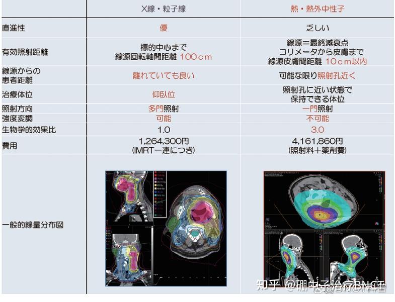 日本BNCT最新临床治疗数据出炉 - 知乎