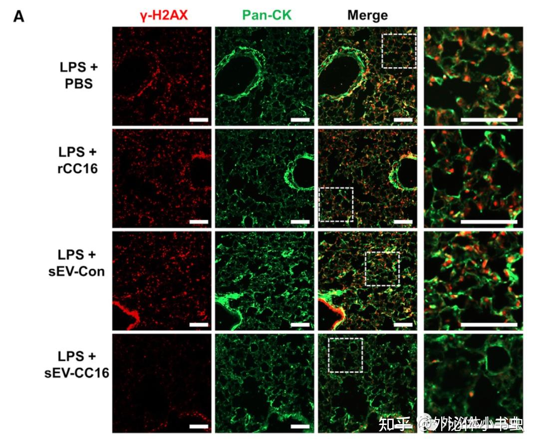 文献分享【Mol. Ther.】外泌体装载CC16蛋白治疗肺急性炎症反应 - 知乎