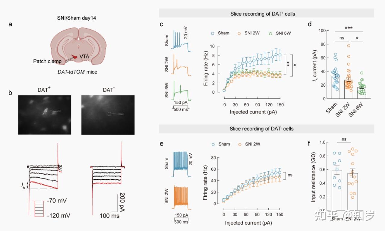 Nature communications|谷氨酸能DRN-VTA通路调节小鼠神经性疼痛和共病快感缺乏样行为 - 知乎