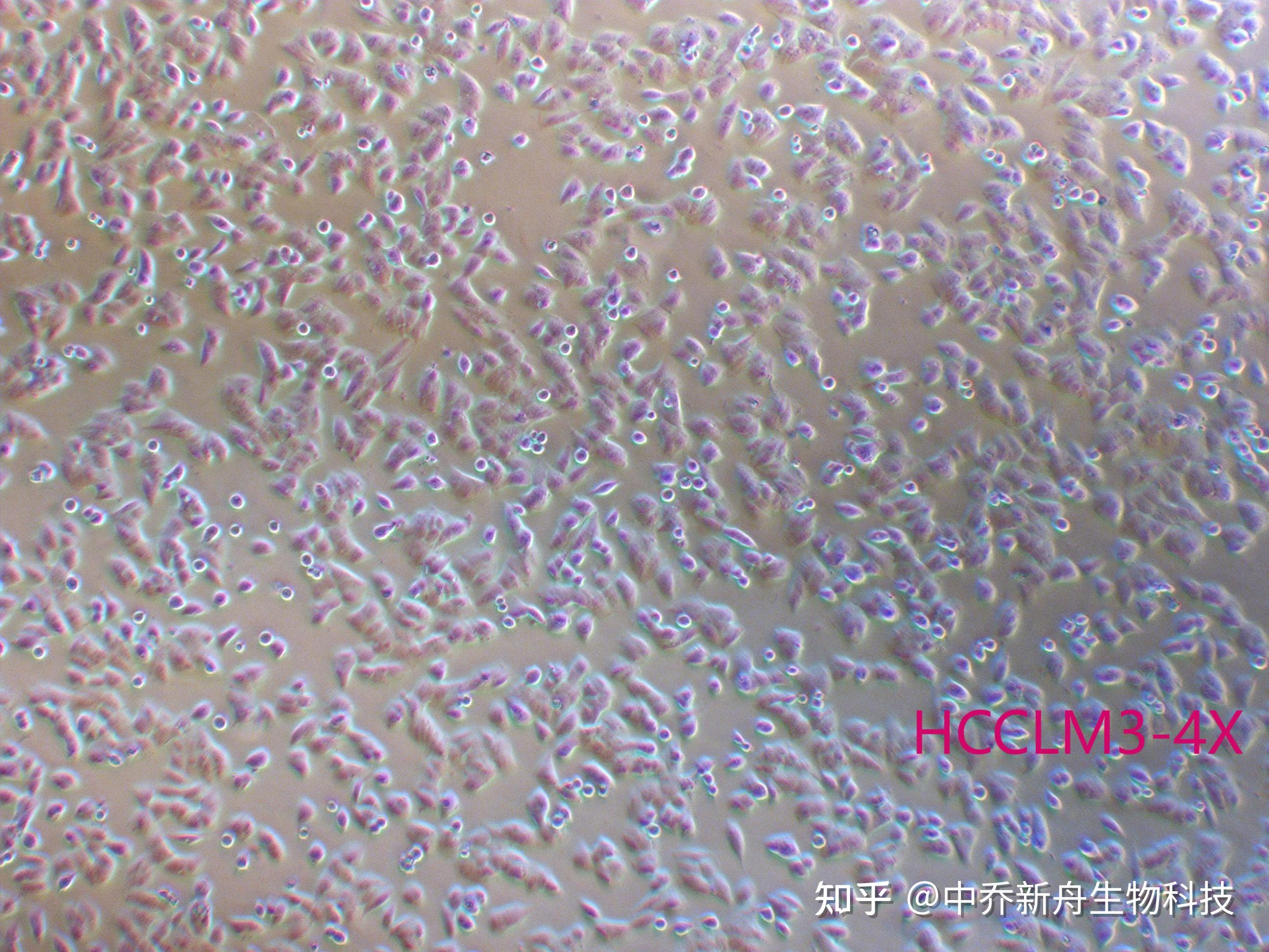 HCCLM3细胞培养实验操作方法和复苏 - 知乎
