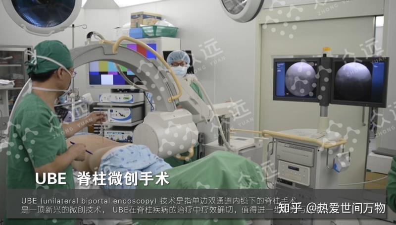 UBE技术简介 - 知乎