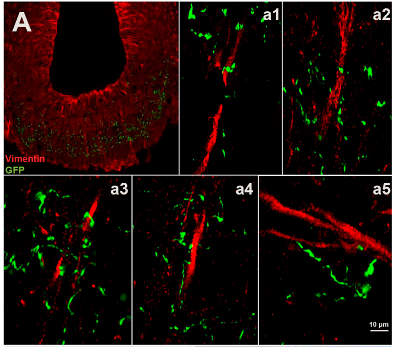 【文献解读】MCH的神经元投射到ME脑区，调控其屏障作用 - 知乎
