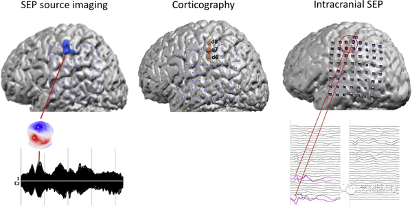 EEG源定位 - 知乎