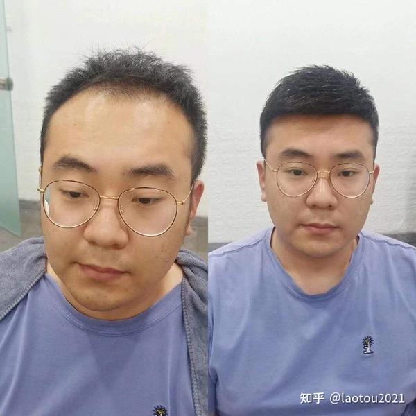 定制的男士假发价格一般多少钱呢?假发定制一般需要多久? 知乎