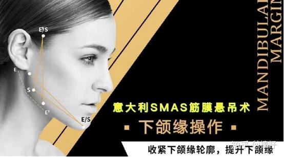 了解了解:意大利筋膜悬吊术smas筋膜层悬吊是什么？ - 知乎