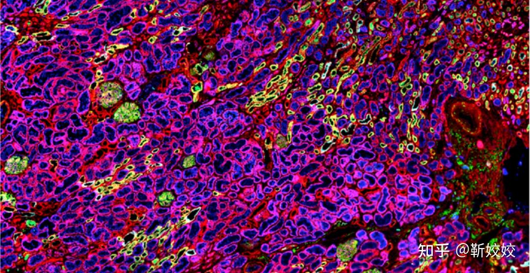 你所知道或不知道的三个人类图谱工作联盟（HuBMAP，HTAN，HCA）和图谱创建那些事 - 知乎