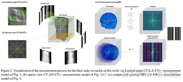 CVPR 2023 | 把扩散模型应用到3D医学图像重建！DiffusionMBIR：使用预训练2D扩散模型求解3D逆问题 - 知乎