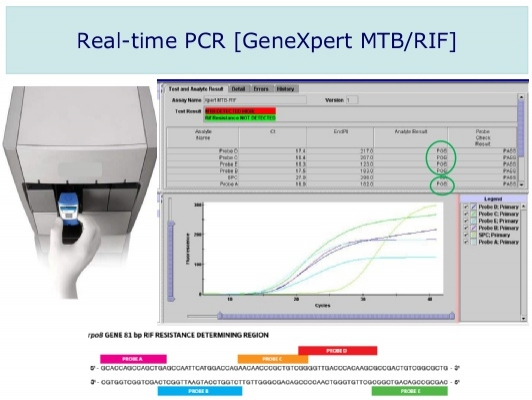 Cepheid公司的GeneXpert芯片检测流程 - 知乎