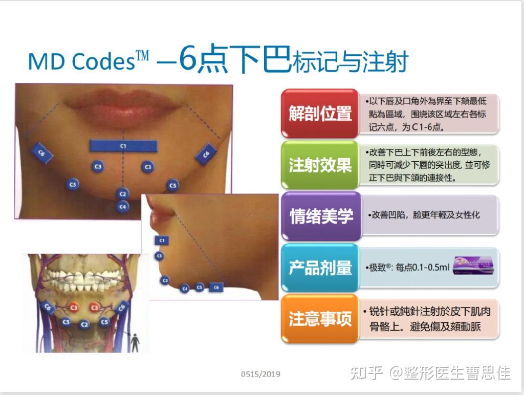 MD Codes 注射法，我为什么不教！ - 知乎