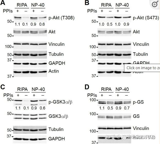 实验技巧篇：最全的western blot操作方法及技巧 - 知乎