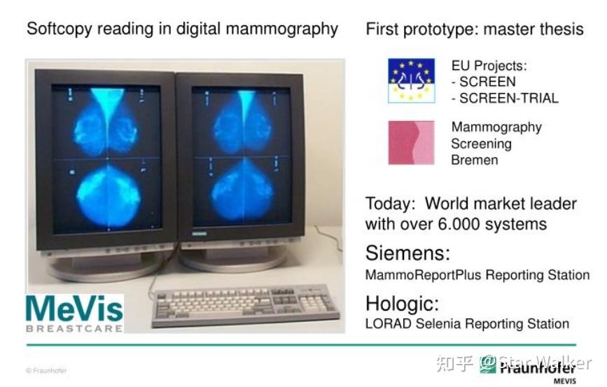 透过MeVisLab，看看德国医疗影像软件公司的生存之道 - 知乎