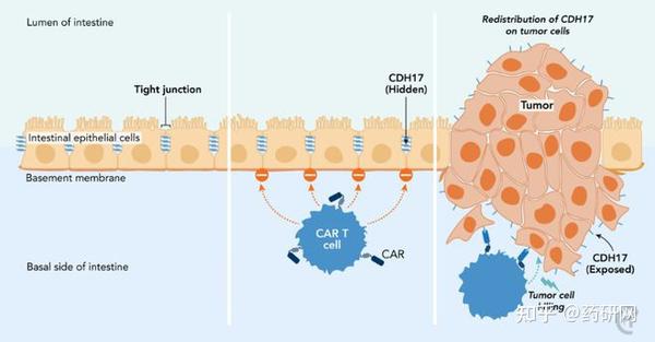 消化道肿瘤靶点新星：CDH17 - 知乎