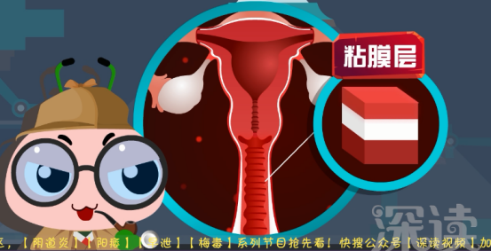 为什么会得阴道炎?揭秘阴道炎的发病机制,三分钟让你做明白女人 知乎