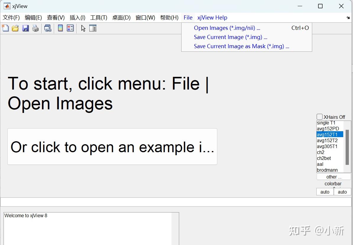 15（1）-SPM-fmri任务态 结果查看与汇报 xjview - 知乎