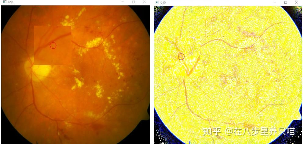 眼底图像处理系统 - 知乎