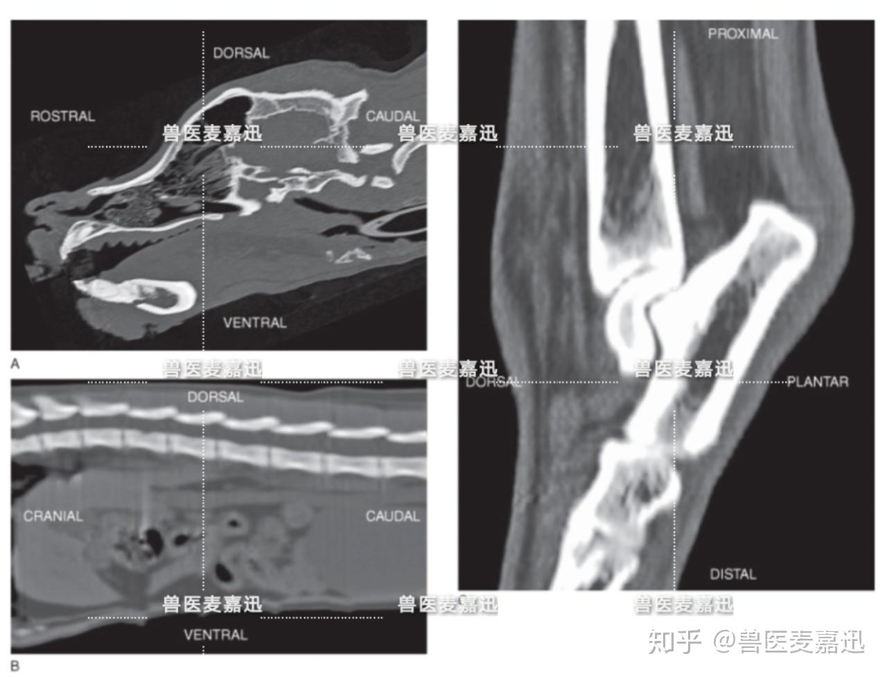 CT基础篇—方位术语与扫描平面 - 知乎